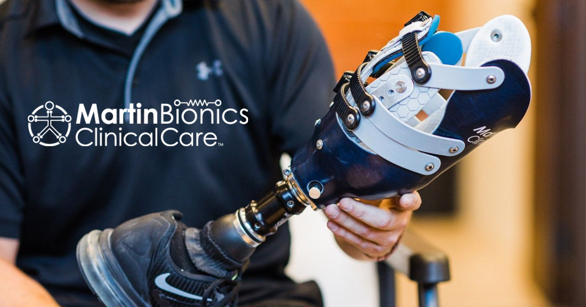 Martin Bionics Prosthetics + Research — Discover comfort today!